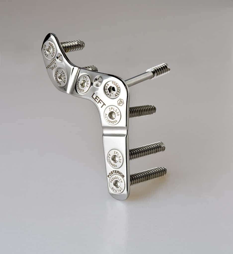 Tornier Calc Plate - LiFT creative studios